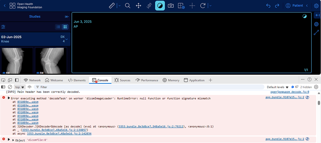 Unable to view AP(Anterior Posterior) images in OHIF version 3.9 / 3.10.1 - Development - Open ...