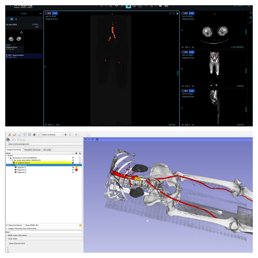 3D segmentation is not visualising as expected in 3D but its Working perfectly in 3D Slicer ...