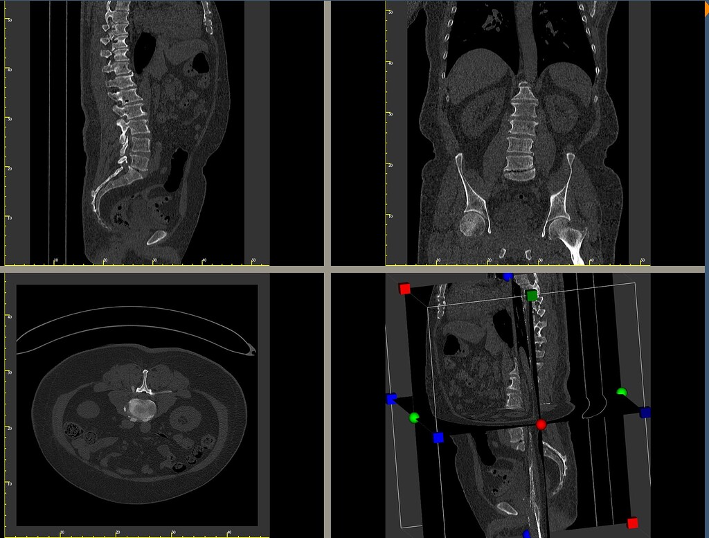 How to create an image with intersecting 3D 3D slices? - Support - Open ...